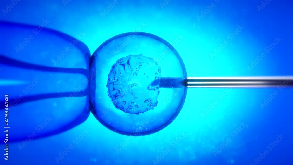 In Vitro fertilisation process through a microscope. Laboratory ...