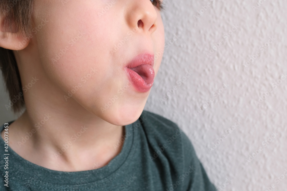 Small Child Kid Performs Articulation Exercises For Mouth Oral Cavity small-child-kid-performs-articulation-exercises-for-mouth-oral-cavity