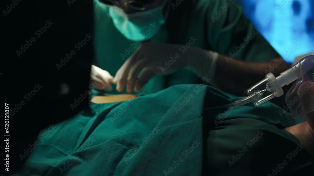 B roll of Demonstration or simulation of surgery in a hospital. Asian ...