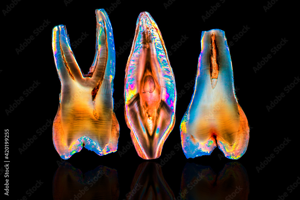 tooth slice cross polorized picture ,focus on the slice edge Stock ...