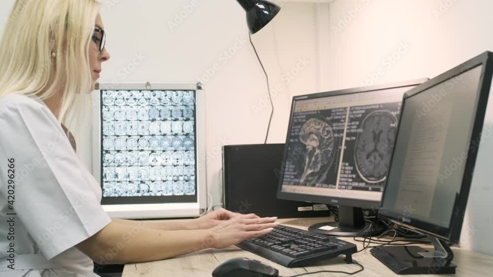 Vidéo Stock Professional female doctor radiologist examines brain CT or ...