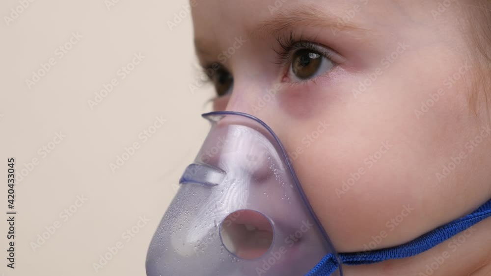 A cute baby in a mask is breathing through an inhaler. Home inhalation ...