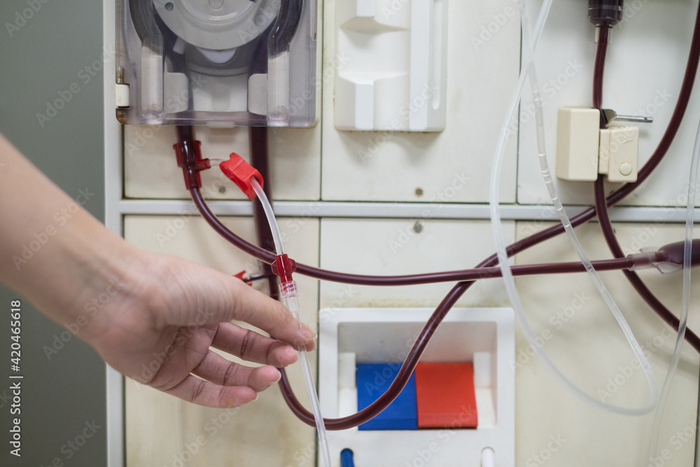 Dialysis machine is working. Acting as a substitute for the kidneys to ...
