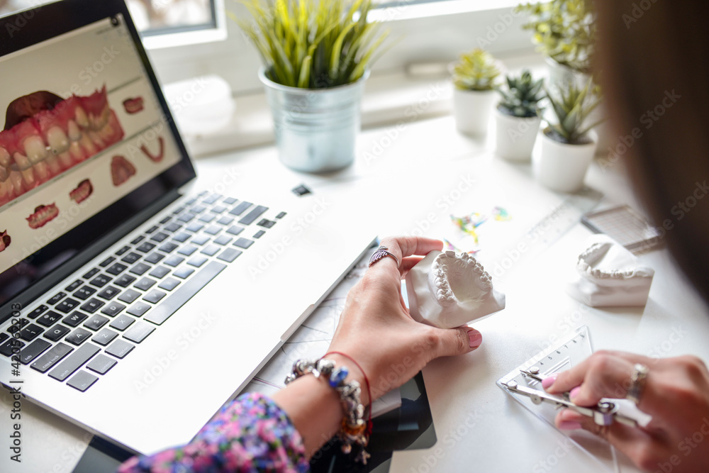 Orthodontic treatment planning Stock Photo | Adobe Stock