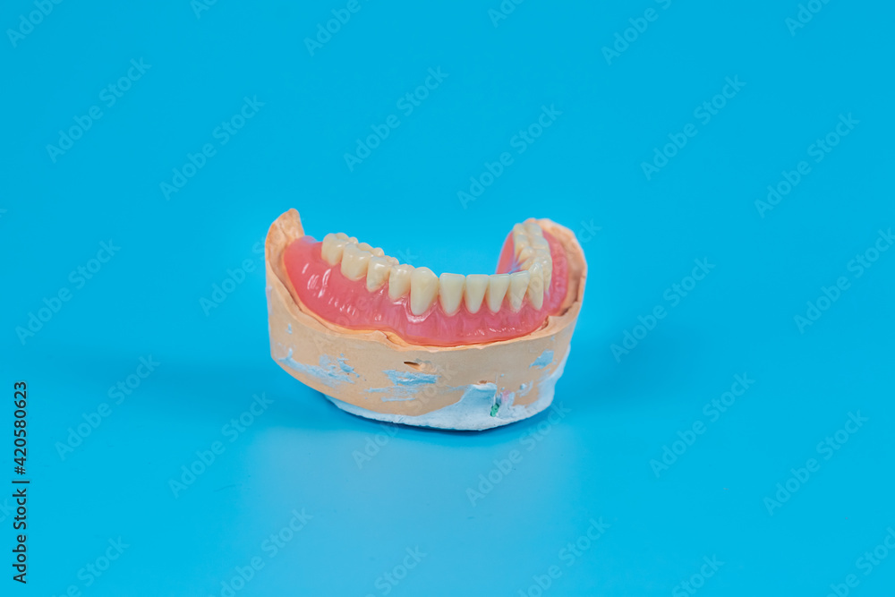 Artificial jaw, visual aid for dentists and patients on a blue ...