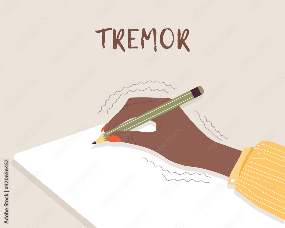 Tremor hands. Primary symptom Parkinson disease. Arms writing with a ...
