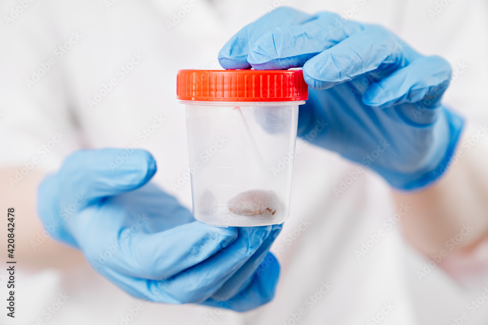 container in hand.collecting feces for analysis on helminths and ...