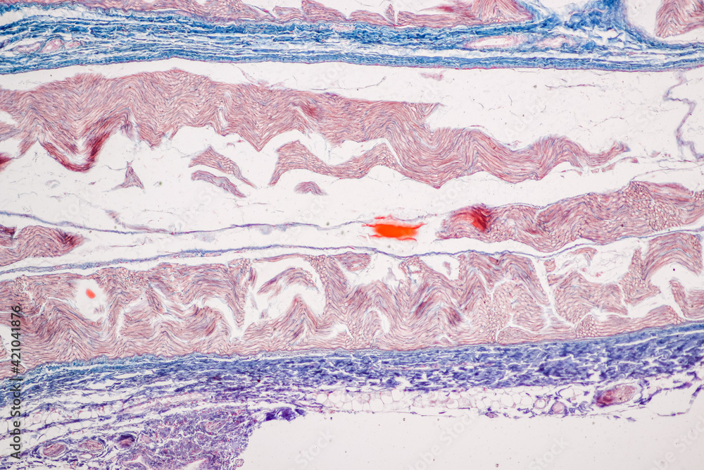 Education Spinal cord, Nerve, Cerebellum, Cortex and Motor Neuron Human ...