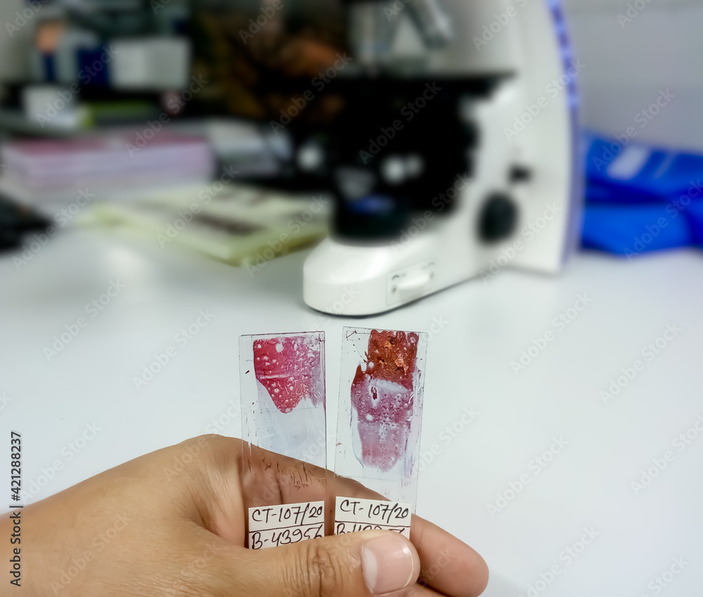 Doctor or Scientist holding microscopic glass slide for the diagnosis ...