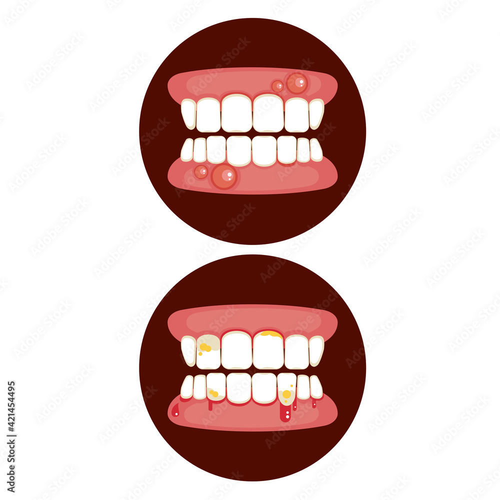 swollen gum icon Stock Vector | Adobe Stock