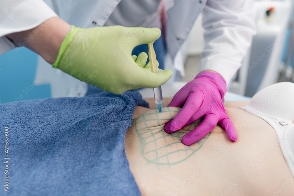 Doctor makes injection of ozone gas in patient abdomen on side on ozone ...