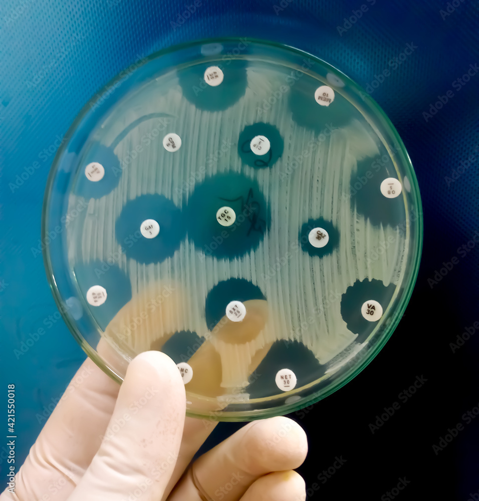 Foto de Antimicrobial susceptibility testing in petri dish. Antibiotic ...
