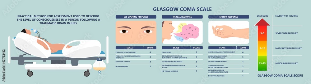 Glasgow Coma Scale avpu alert verbal pain patient score first aid test ...