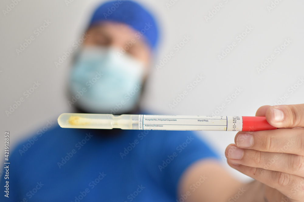 Nurse holding a tube. Rotavirus test. Man wearing a face mask grabbing ...