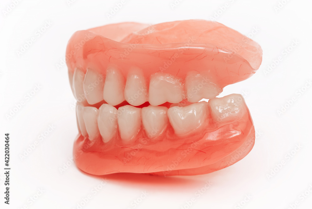 Full removable plastic denture of the jaws. Set of dentures on a white ...
