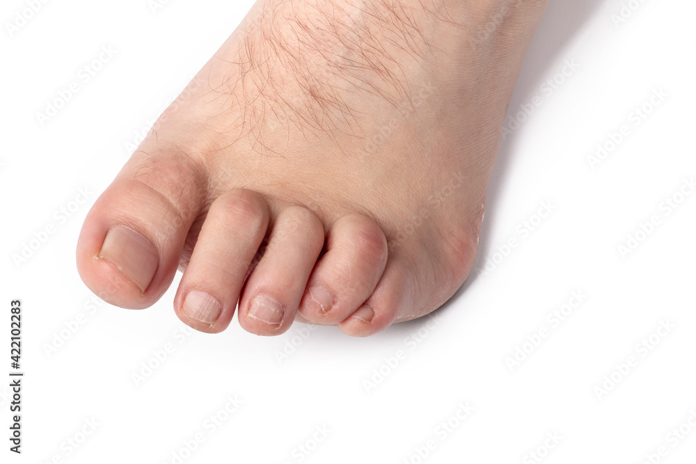 studio lighting. a human leg on a white background. The finger is ...