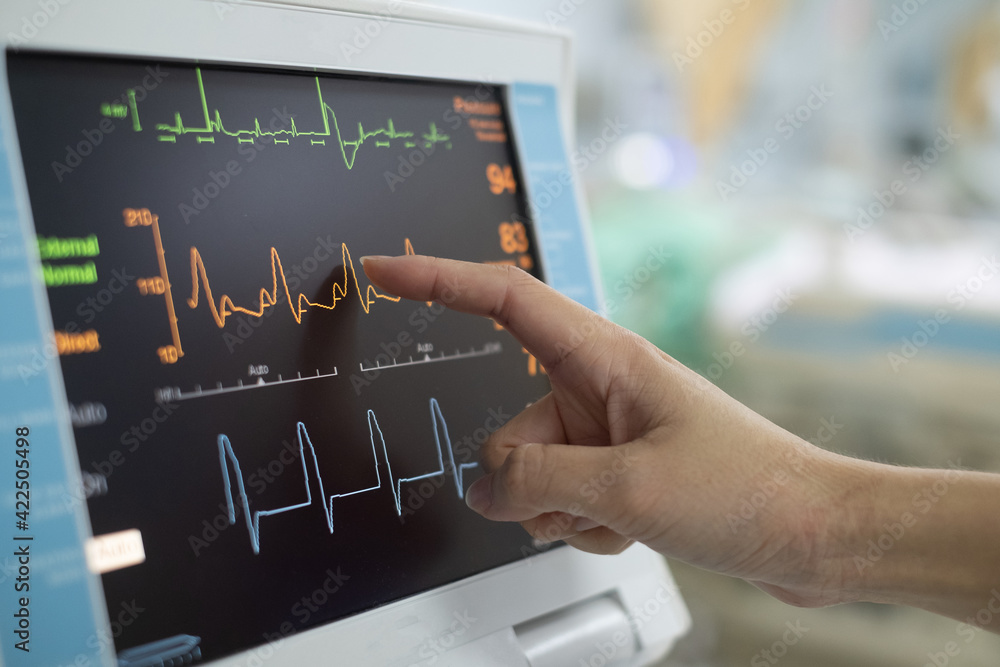 EKG monitor in intra aortic balloon pump machine. Medical equipment in ...