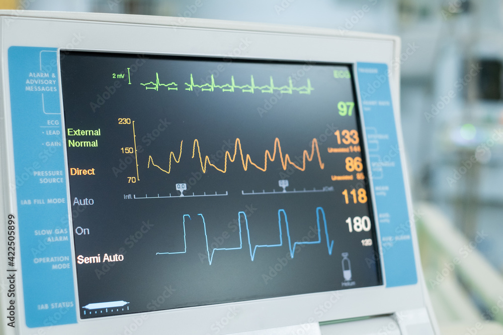 EKG monitor in intra aortic balloon pump machine. Medical equipment in ...