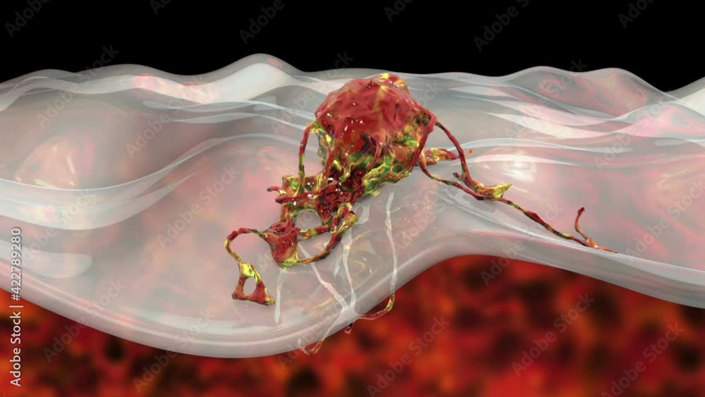 Invasive cancer growth, 3D animation showing tumor invasion into ...