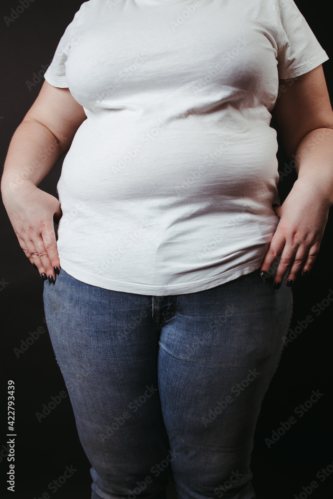 Fat people. Overweight woman at studio background Stock Photo | Adobe Stock