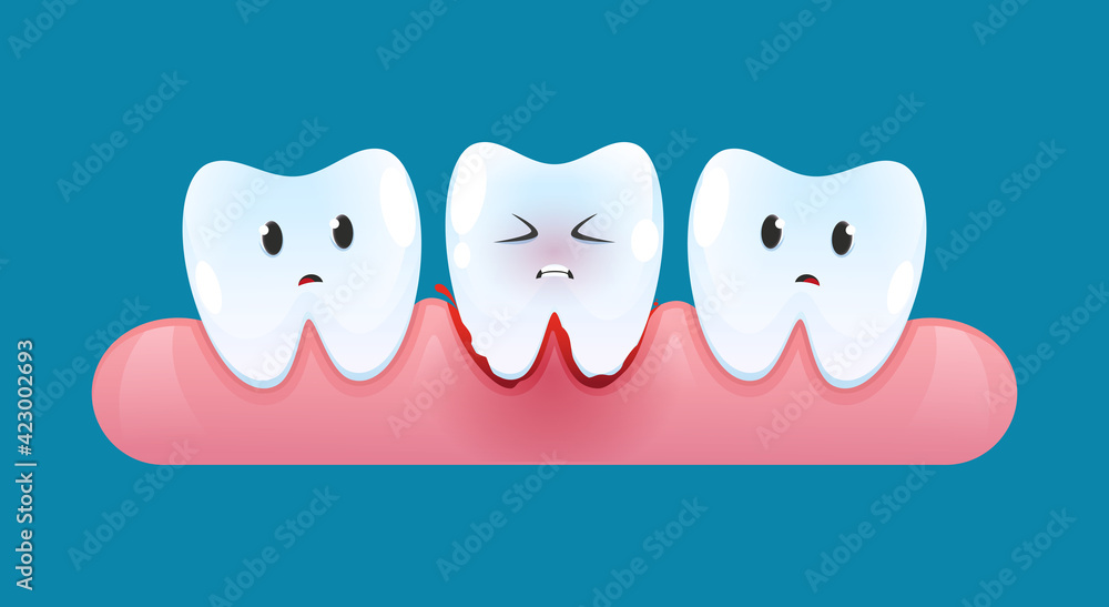 Tooth is bleeding in the gum. Blood teeth. Vector cartoon style. Stock ...