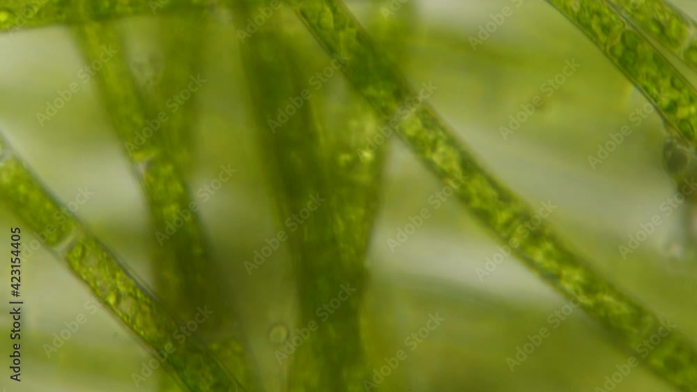 Chloroplast under a microscope. Cell division. Cell structure. Cell ...