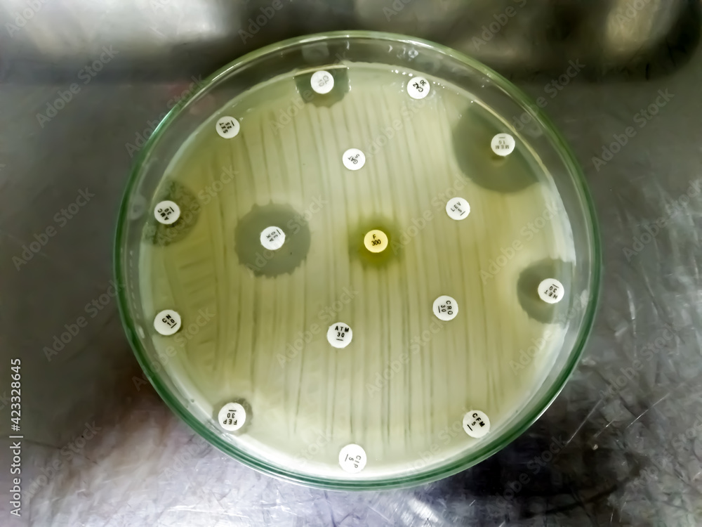 Foto de Drug Sensitivity testing in Mueller-Hinton agar media ...