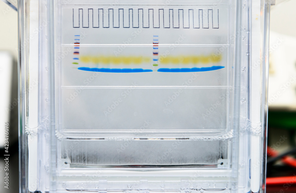 Protein ladder and protein samples on SDS-PAGE for interesting protein ...