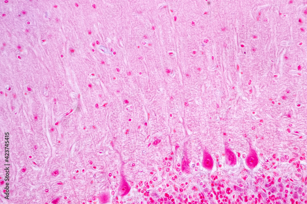 Education Spinal cord, Nerve, Cerebellum, Cortex and Motor Neuron Human ...