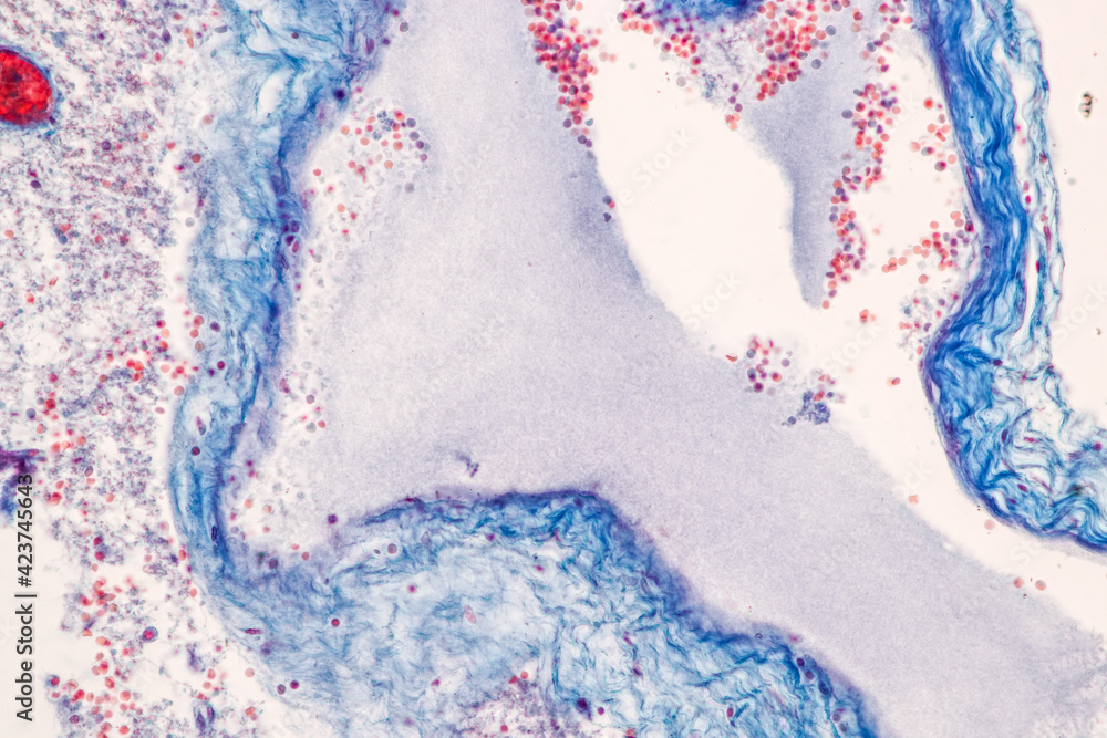 Education Spinal cord, Nerve, Cerebellum, Cortex and Motor Neuron Human ...