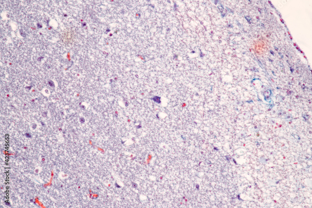 Education Spinal cord, Nerve, Cerebellum, Cortex and Motor Neuron Human ...