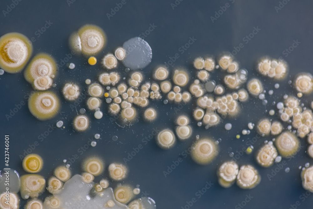 Mold Beautiful, Colony of Characteristics of Fungus (Mold) in culture ...