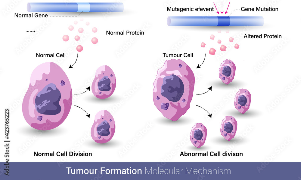 Mechanism of cancer or tumor formation due to mutation or metastasis ...
