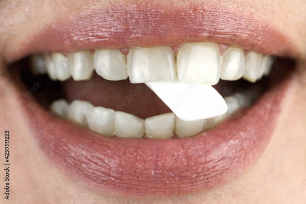 Chewing gum in a woman's teeth, close-up. Stock Photo | Adobe Stock