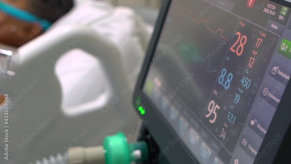 A monitor tracks the vital signs of the COVID-19 P1 Brazilian variant ...