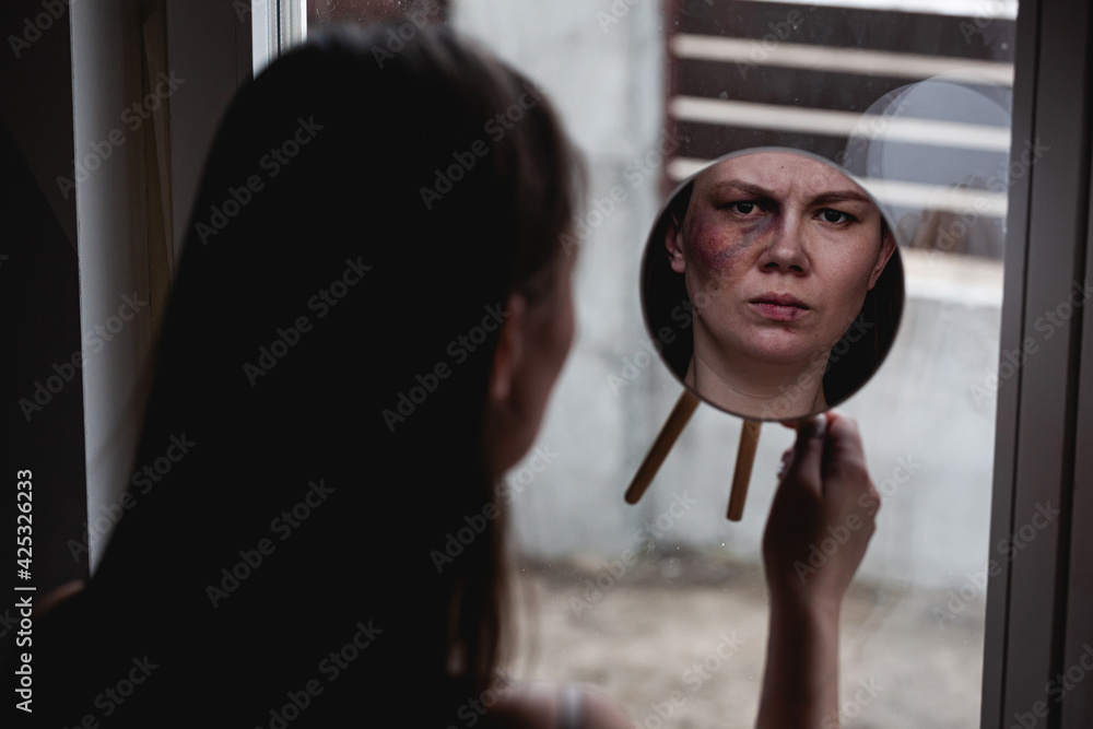 Domestic violence, abuse woman with bruise on face by the window looks ...