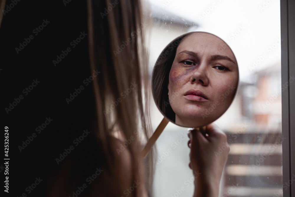 Fotografia do Stock: Domestic violence, abuse woman with bruise on face ...