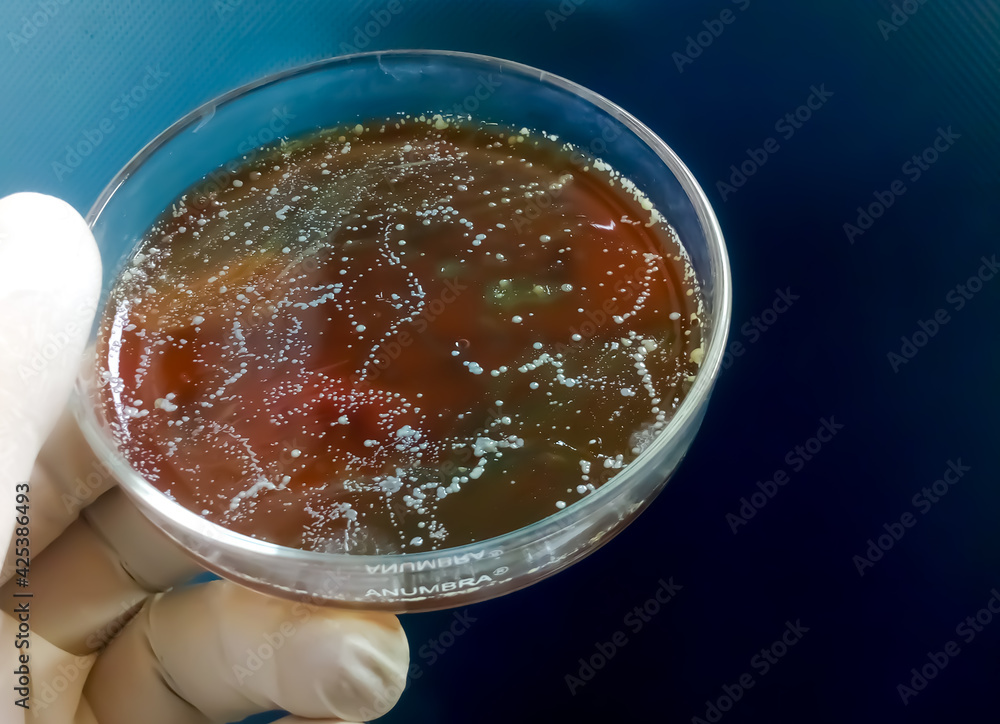 Microbiologist hand hold a Petrie dish with a mixed culture of bacteria ...