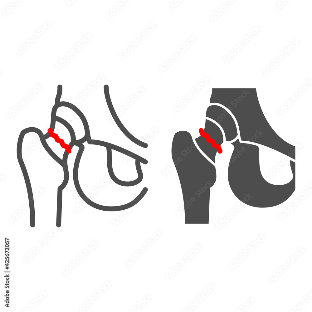 Fracture of femoral neck line and solid icon, Human diseases concept ...