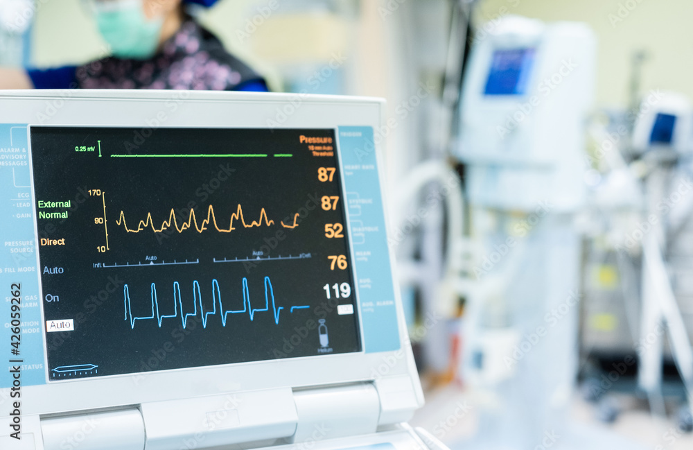 EKG monitor in intra aortic balloon pump machine. Medical equipment ...