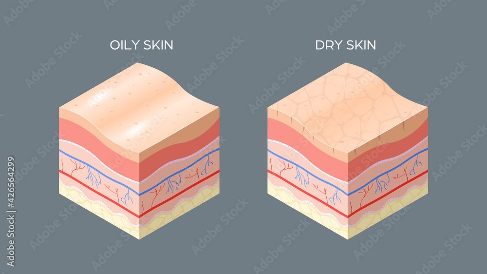 oily and dry skin cross-section of human skin layers structure skincare ...