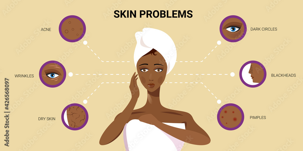 facial skin pimples acne different types on african american woman face ...