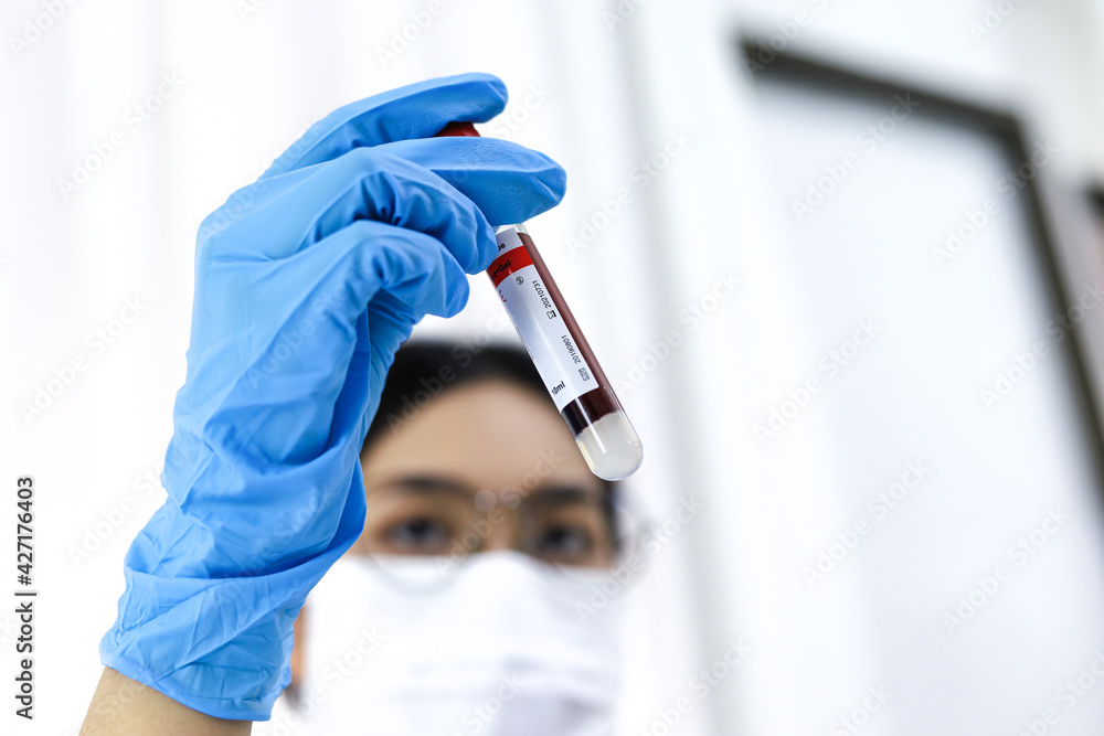 Scientist holding Coronavirus covid-19 infected blood sample tube DNA ...