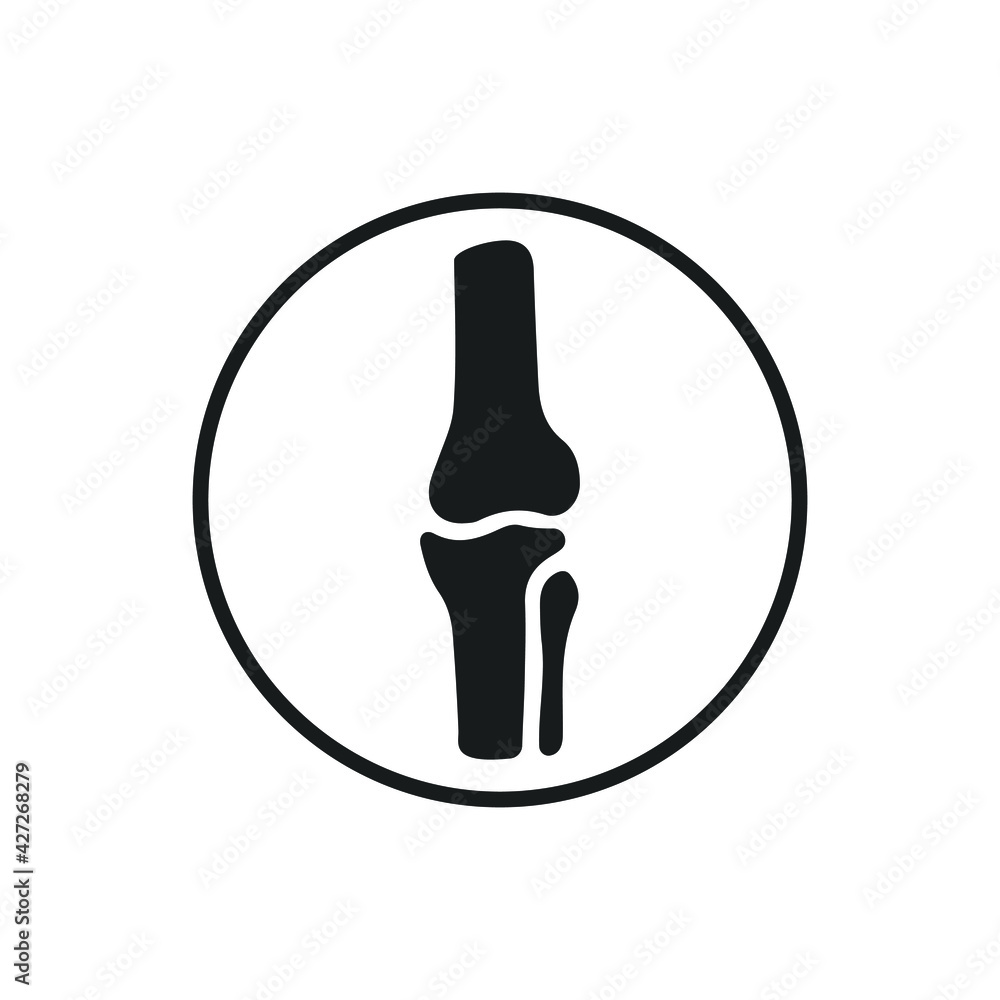 Vector illustration of knee joint isolated on white. Medical icon ...