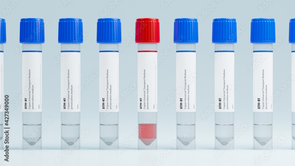 RT-PCR COVID-19 virus disease diagnostic test, DNA nasal and oral ...