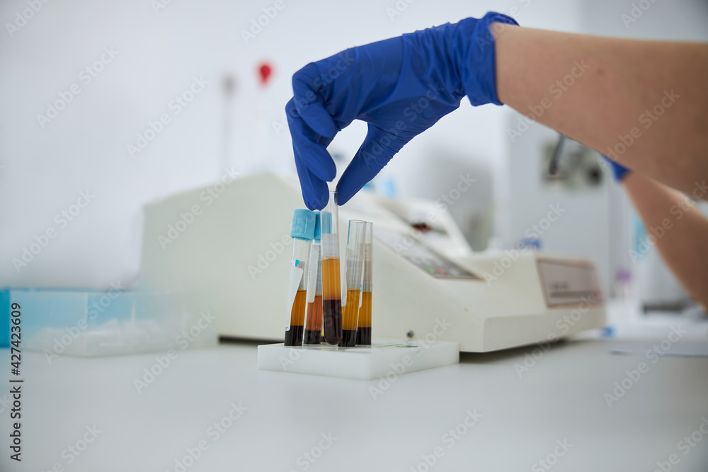 Laboratory worker choosing a sample for a coagulation test Stock Photo ...