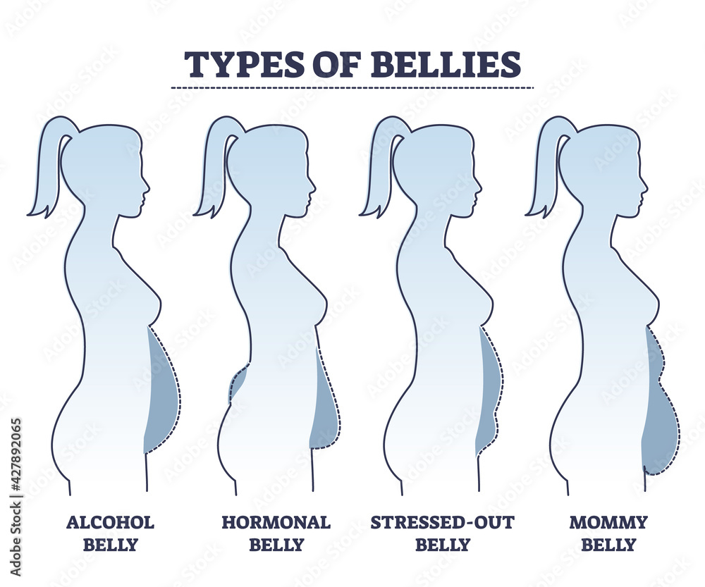 Types of bellies with abdominal fat problem in stomach area outline ...