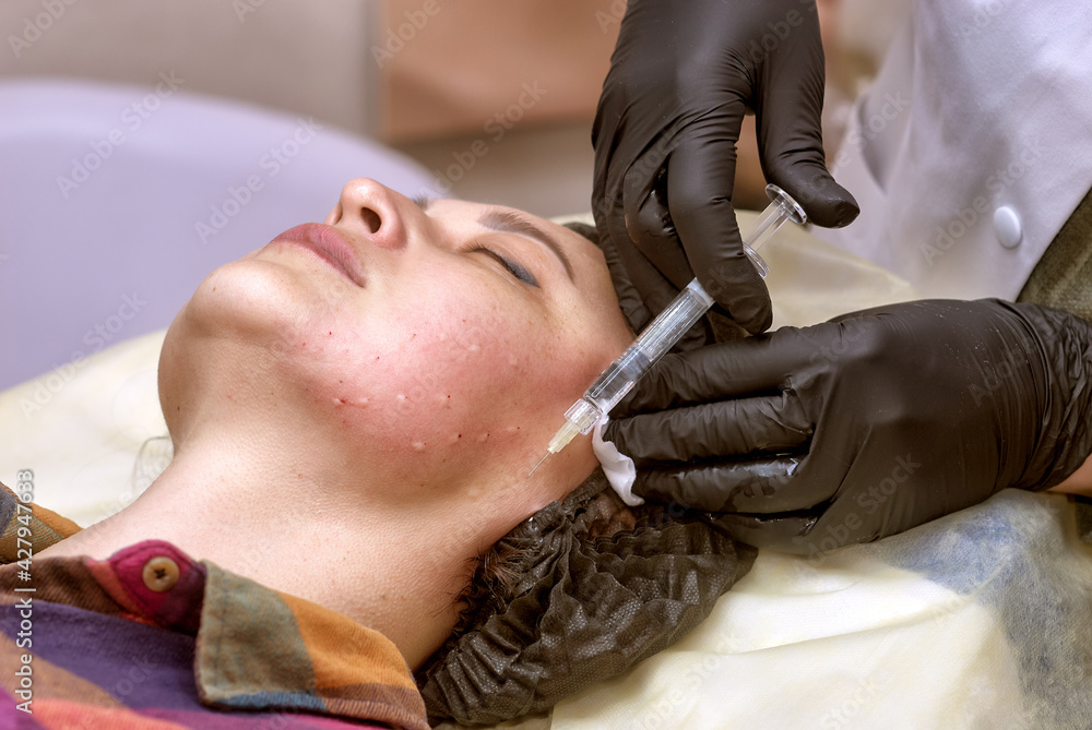 Doctor cosmetologist makes an injection into a woman's face ...