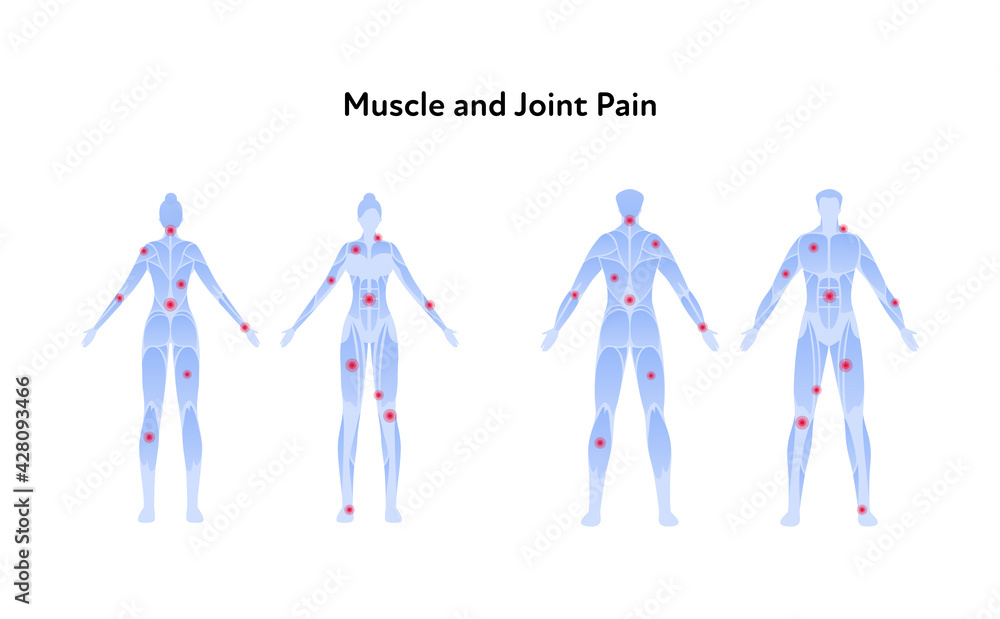 Muscle and joint pain infographic. Vector flat illustration set. Man ...
