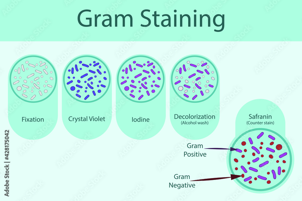 Fototapeta Diagram showing gram staining technique steps - microbiology ...